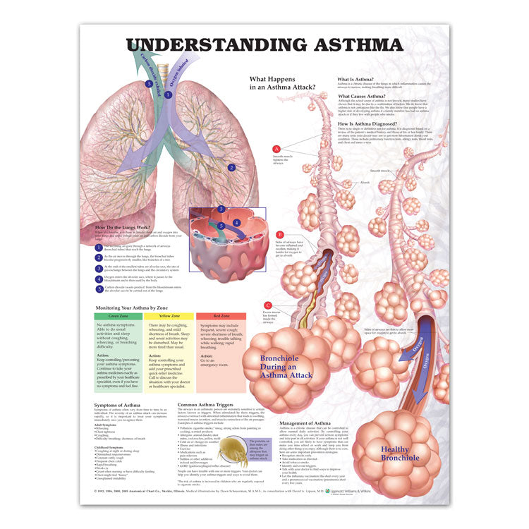 Understanding Asthma Chart – School Nurse Supply